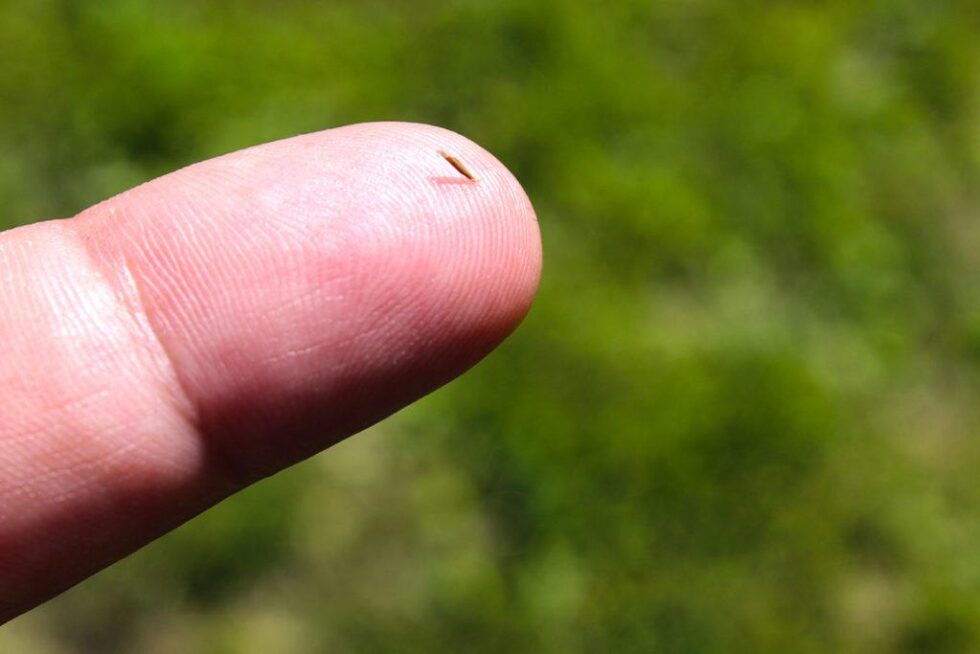 Splinter Removal: A Complete First Aid Guide